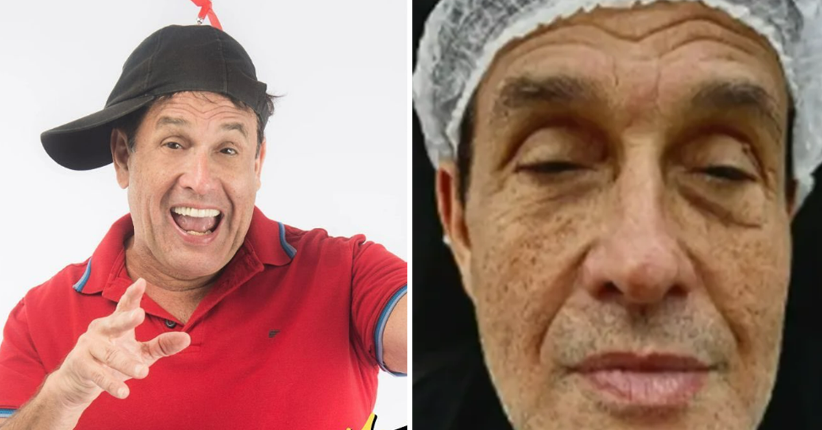 [VÍDEO] Sérgio Mallandro mostra resultado de nova harmonização facial ...